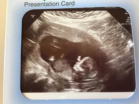 Due date and scan pics