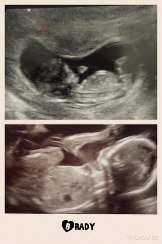 Due date and scan pics