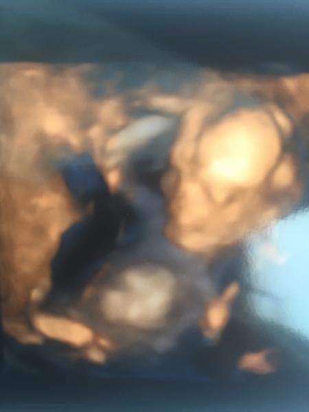 Due date and scan pics