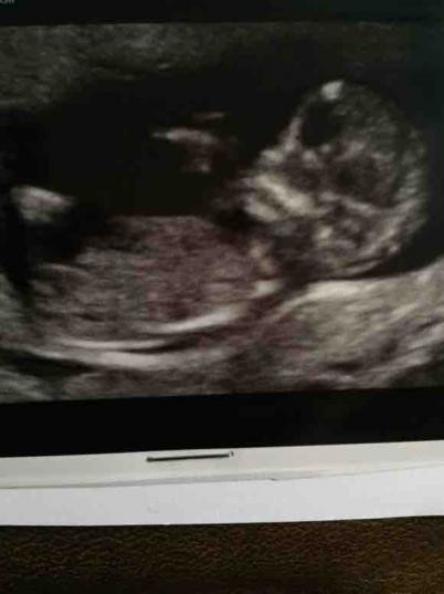 12 week scan...guess the gender just for FUN