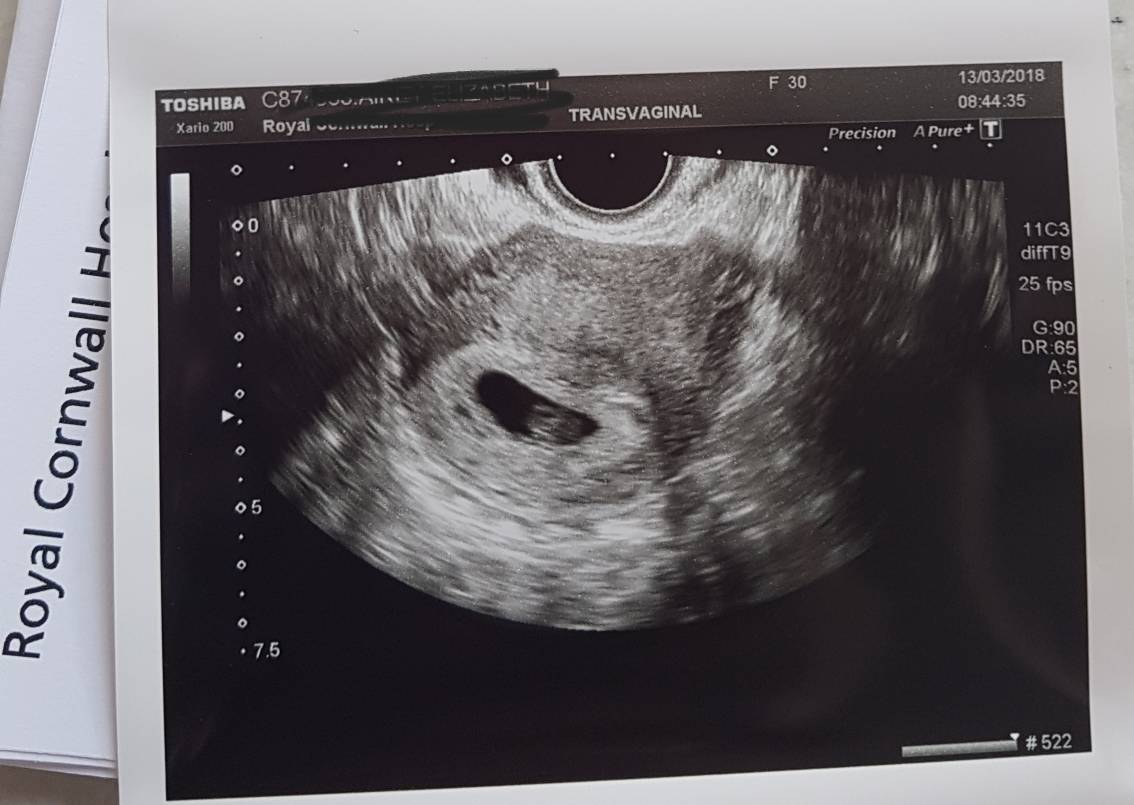 Weeks scan.. Anybody know?