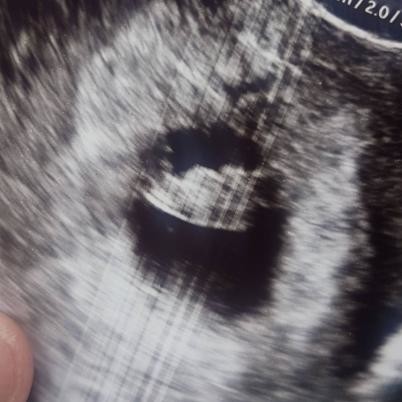 Weeks scan.. Anybody know?