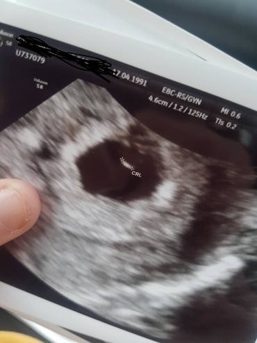 EPU Scan 5 weeks 3 days