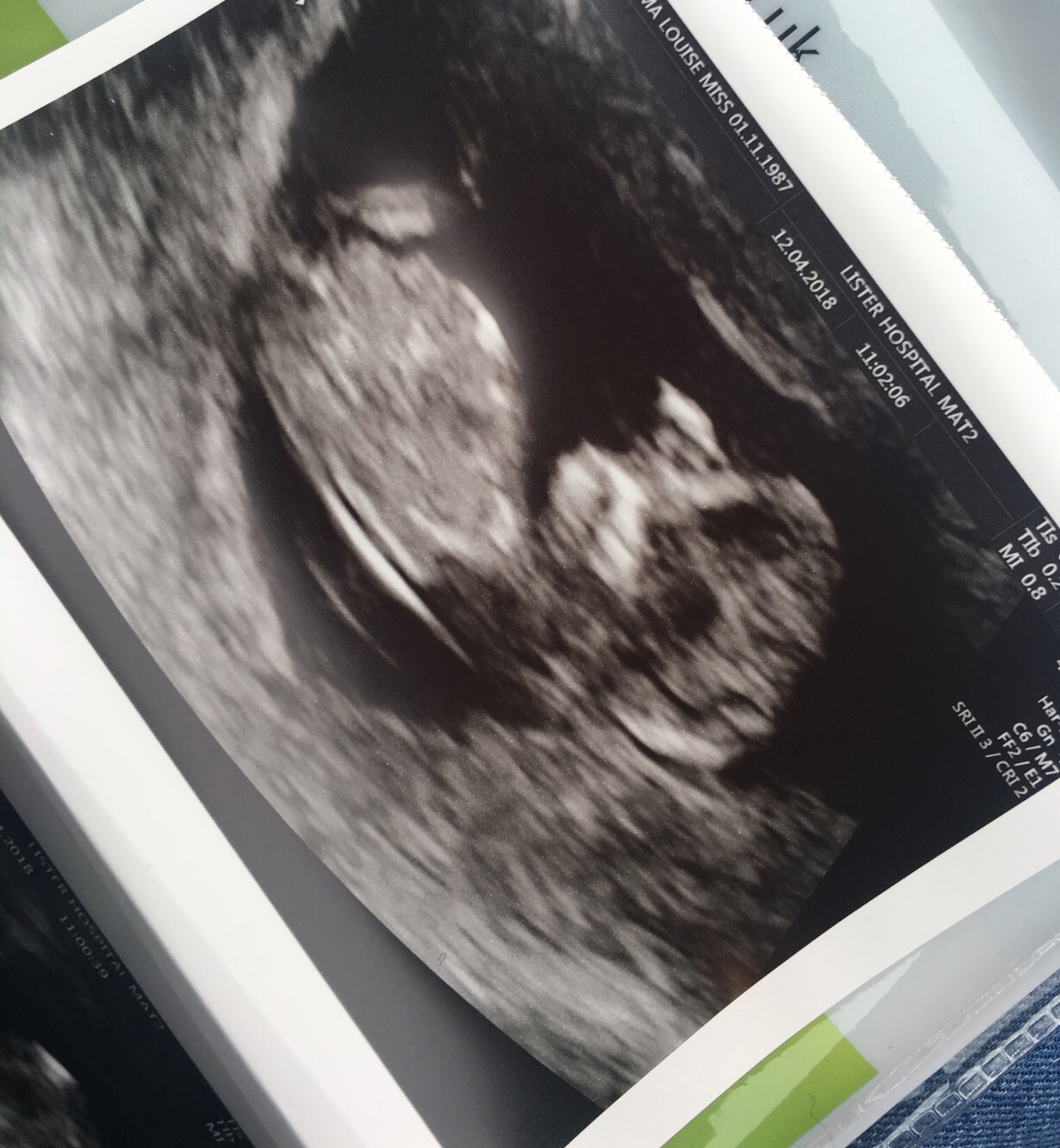 12 weeks - nub theory? Share yours....