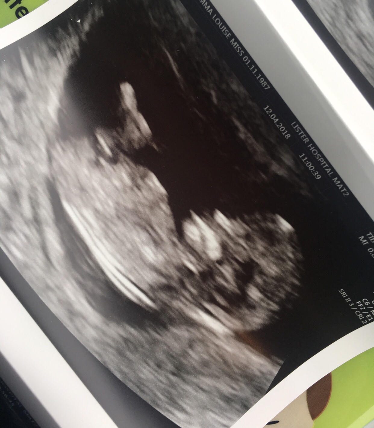 12 weeks - nub theory? Share yours....