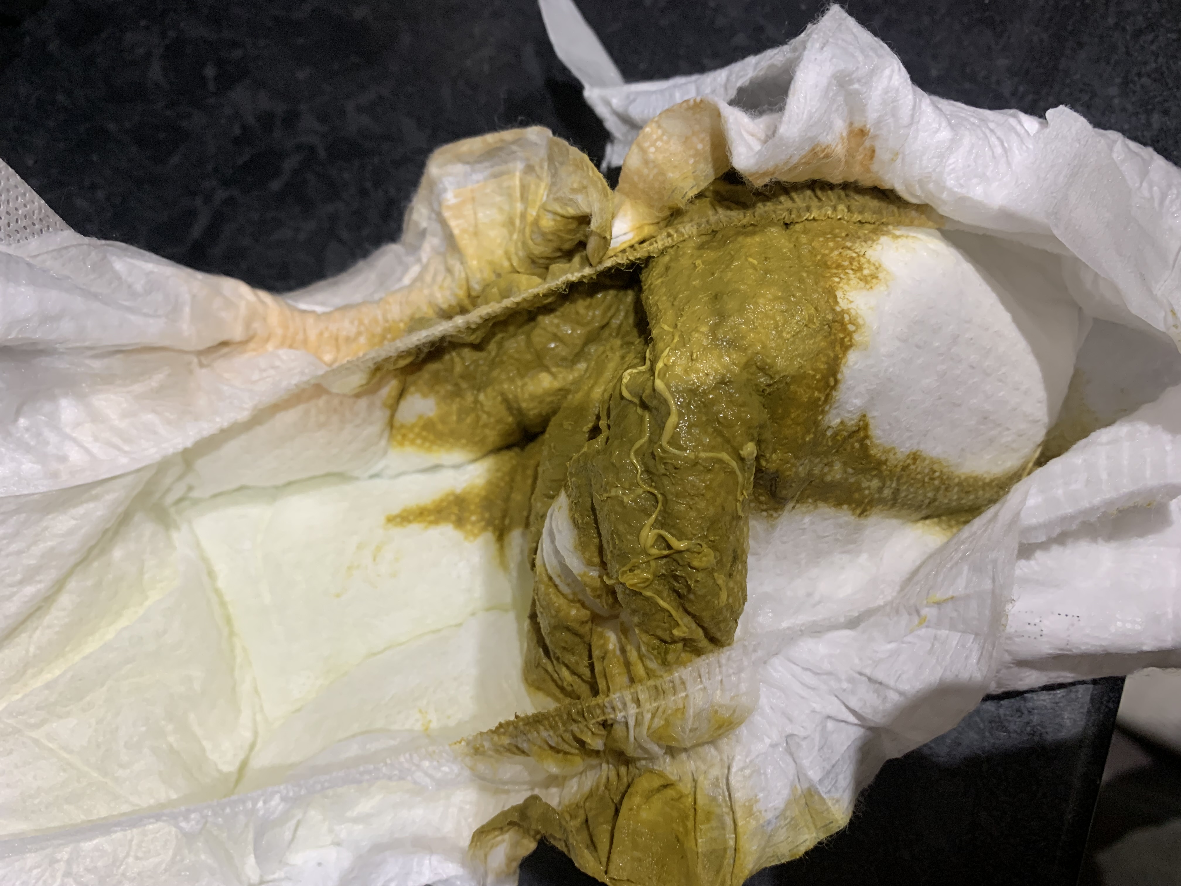 mucus in stool threadworms