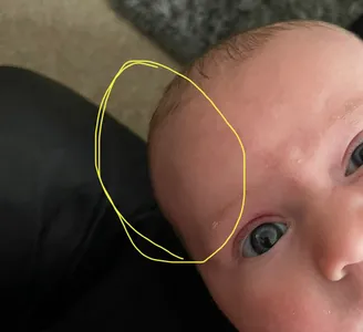 Lump in babies head??!!