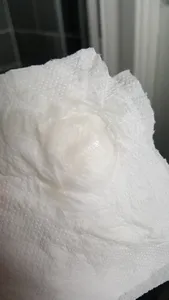 Yellow Discharge In Underwear