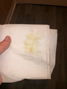 12dpo Cm **TMI PICS SORRY!**